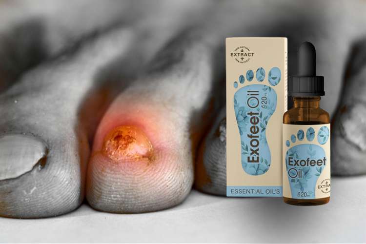 Exofeet Oil Recenze, Podvod? Cena, Kde koupit? Lékárna, Dr Max? Fórech ...